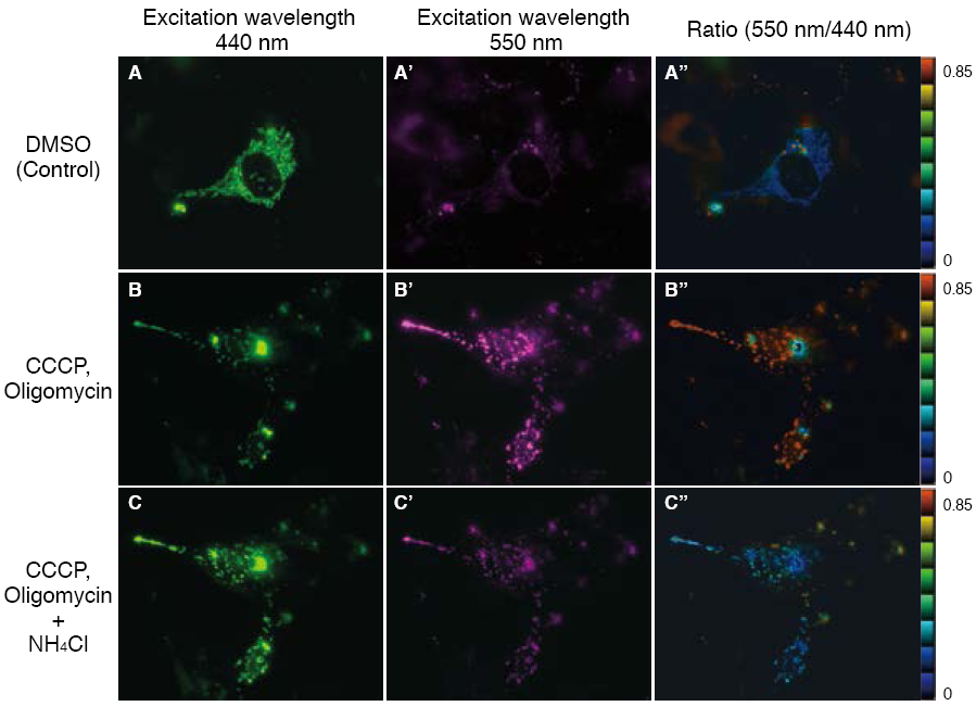 Investigating Parkinson's Disease Part I: Mitophagy & How to Visualize It